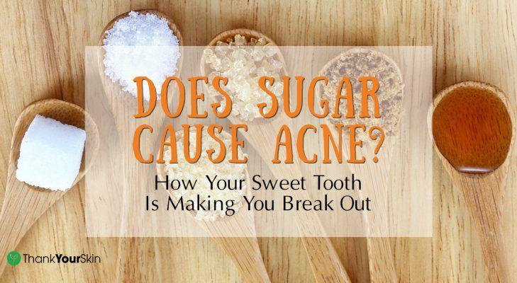 Does Sugar Cause Acne? (The Truth Finally Revealed!)