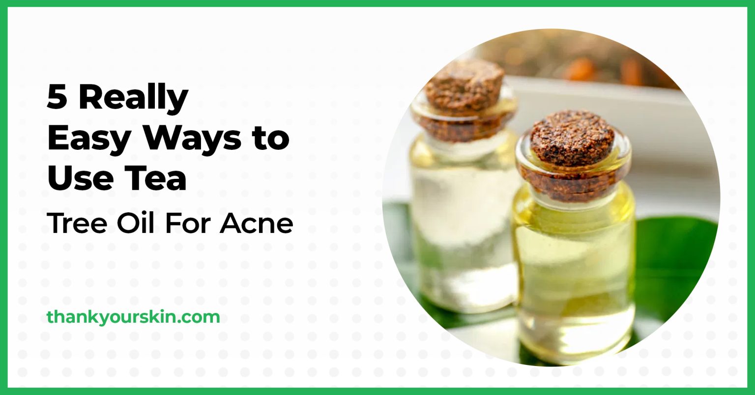 5 Really Easy Ways to Use Tea Tree Oil For Acne