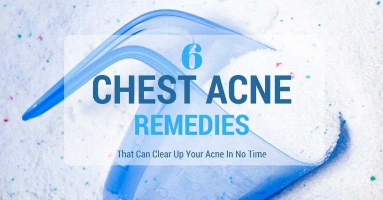 6 Super Effective Remedies That Can Clear Up Your Chest Acne In No Time