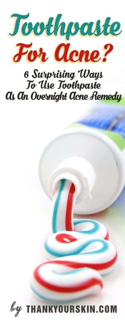 Toothpaste For Acne? 6 Surprising Ways To Use Toothpaste As An ...
