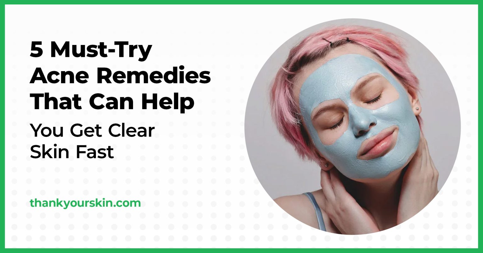 5 Must-Try Acne Remedies That Can Help You Get Clear Skin Fast
