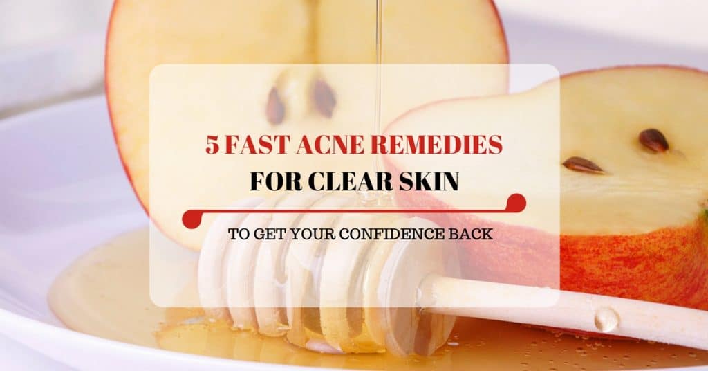 5 Must-Try Acne Remedies That Can Help You Get Clear Skin Fast
