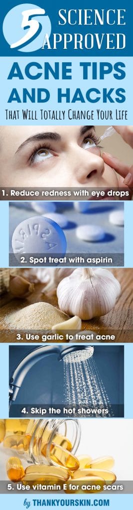 5 Science-Approved Acne Tips And Hacks That Will Totally Change Your Life