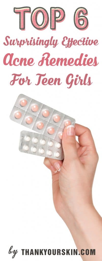 6 Surprisingly Effective Acne Remedies for Teen Girls