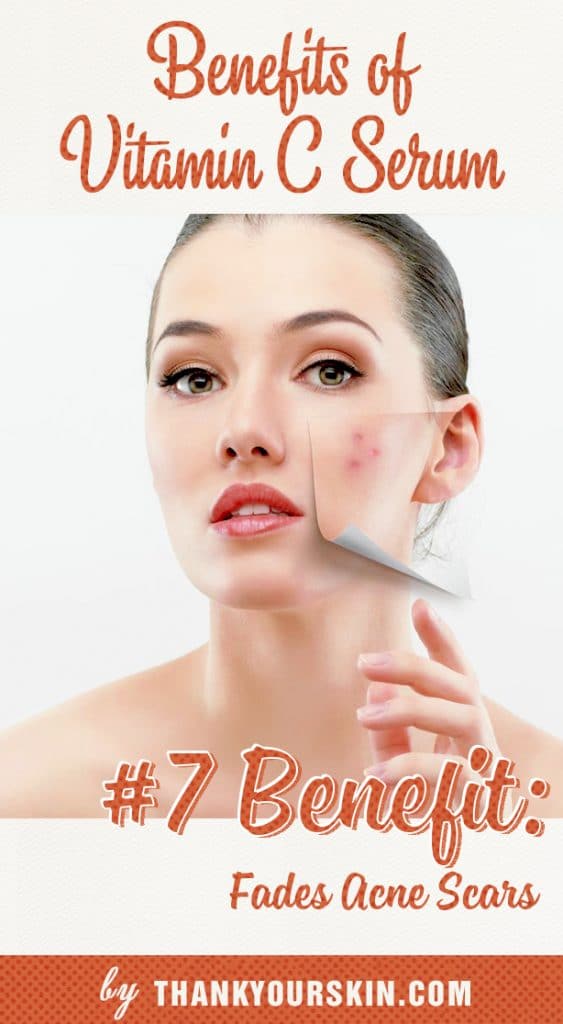 7 Amazing Benefits of Vitamin C Serum For Your Skin