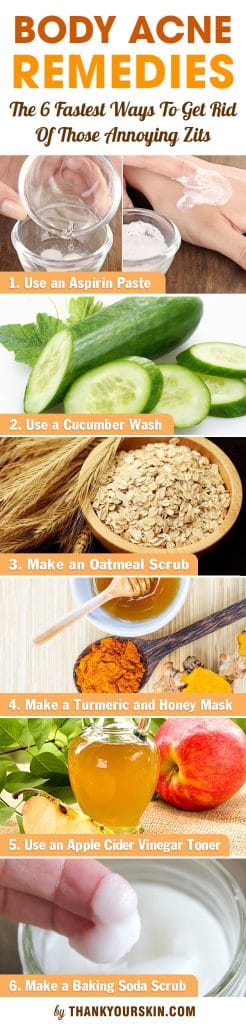 Body Acne Remedies: The 6 Fastest Ways To Get Rid of Those Annoying Zits
