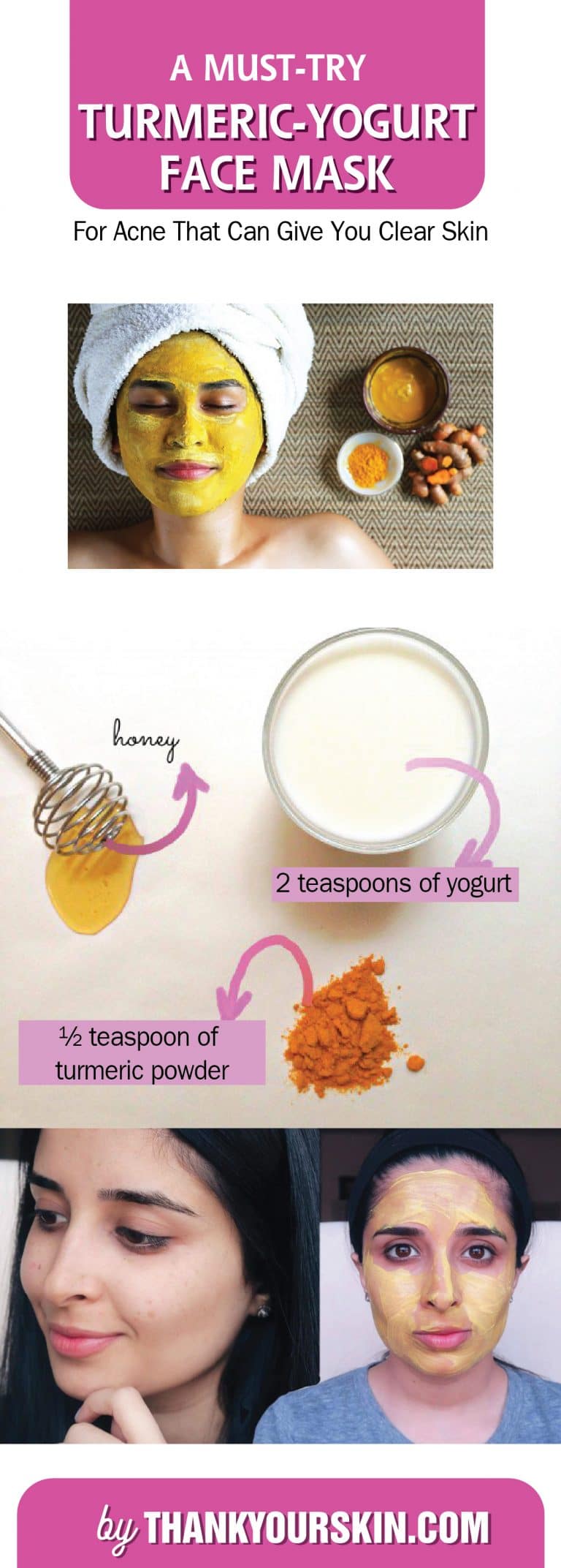 23 Homemade Face Masks For Acne That Actually Work