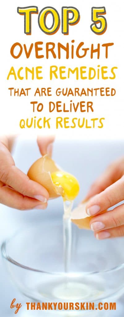 5 Overnight Acne Remedies That Are Guaranteed To Deliver Quick Results