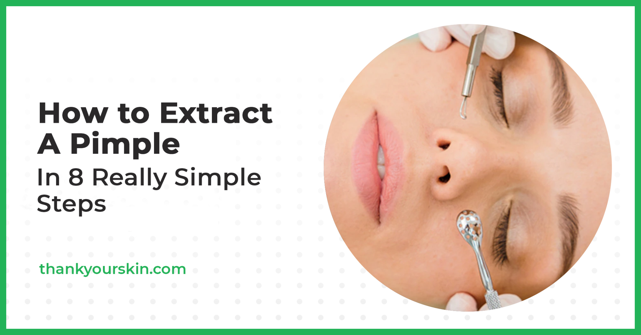 How to Extract A Pimple In 8 Really Simple Steps