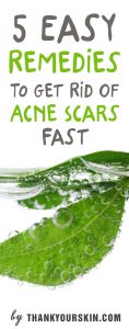 5 Easy Remedies To Get Rid Of Acne Scars Fast