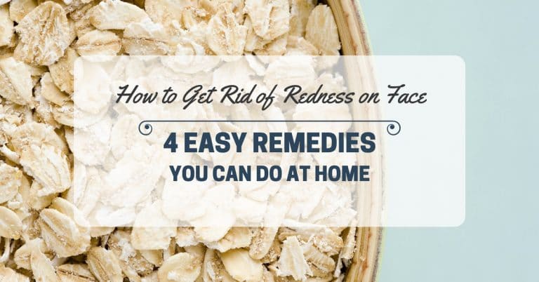 How to Get Rid of Redness on Face: 4 Easy Remedies You Can Do At Home
