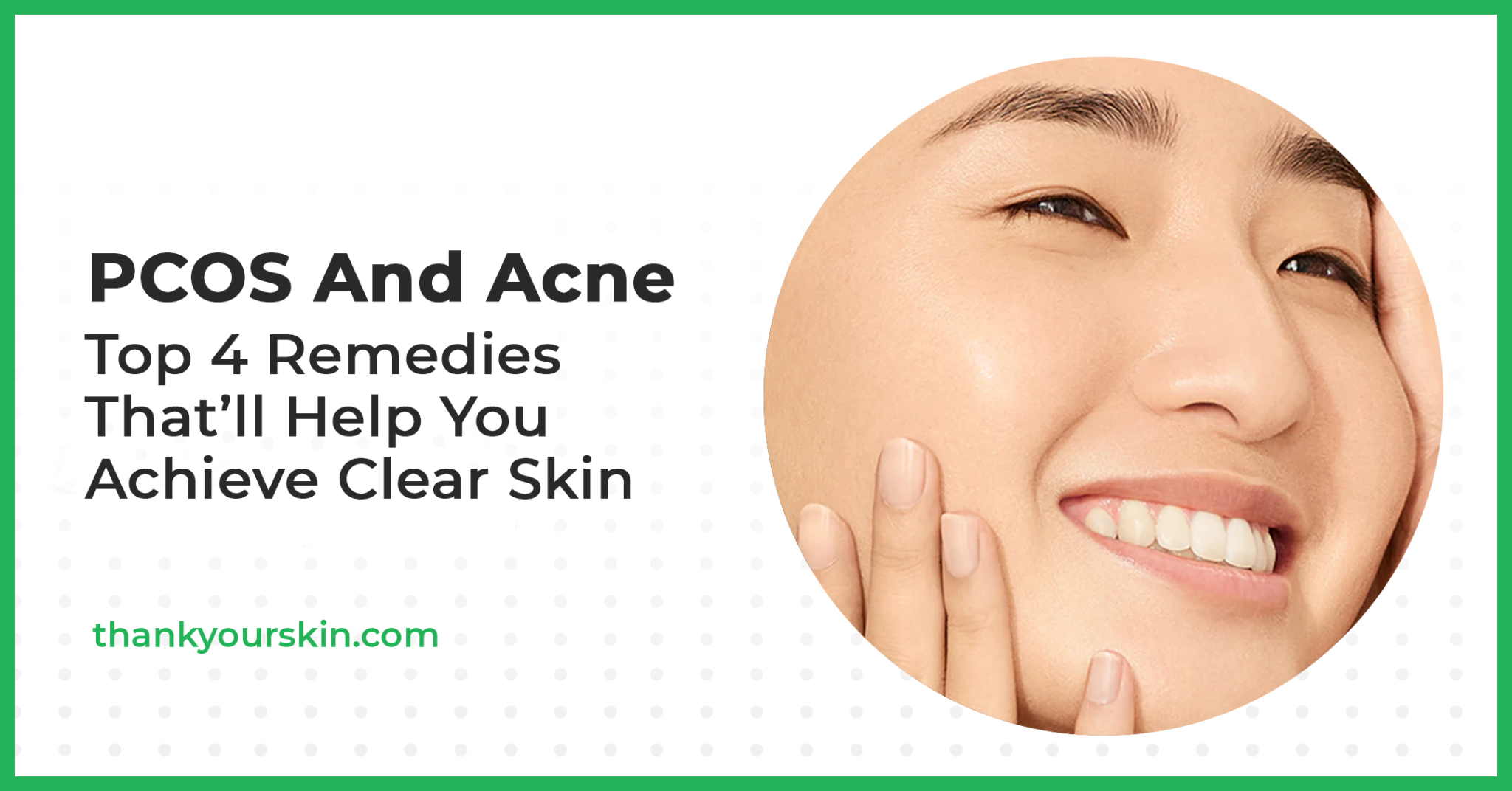 PCOS And Acne: Top 4 Remedies That’ll Help You Achieve Clear Skin